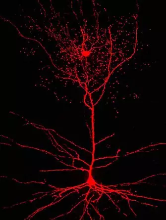 বিজ্ঞানীরা একটি নতুন ধরণের নিউরন আবিষ্কার করেছেন যা মানুষের জন্য অনন্য হতে পারে 10519_5