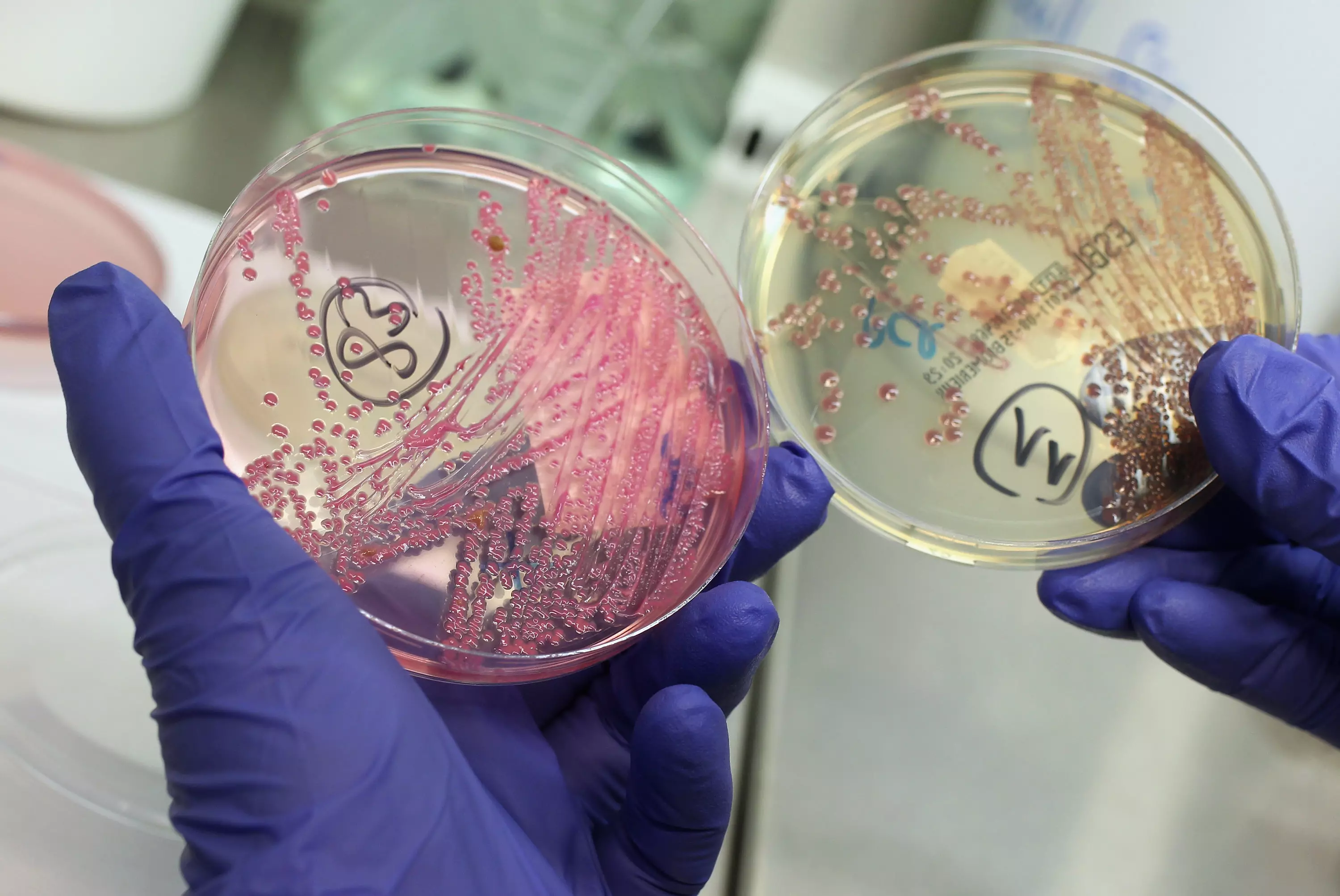 抗生素耐药性：研究人员直接证明，细菌可以在人体内改变形状以避免抗生素 10788_1