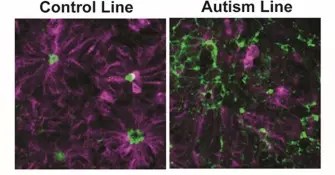 Estudo: os cerebros autistas desenvólvense de forma diferente antes do nacemento 12191_2