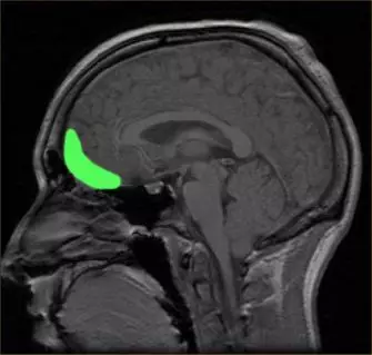 Los científicos descubren cómo la esperanza protege el cerebro 13313_2