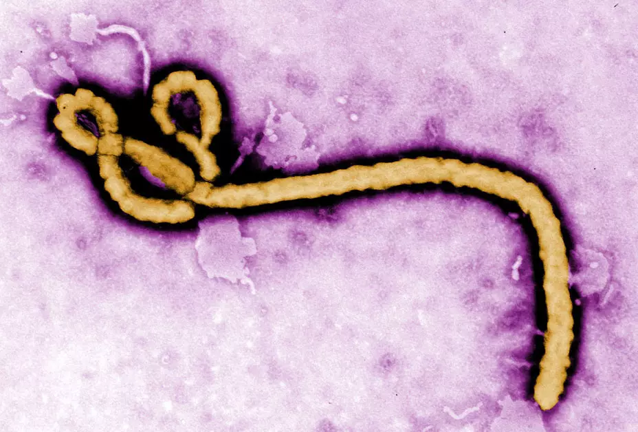 A yanzu duniya tana da rigakafin cutar Ebola, bisa amincewar EU mai tarihi