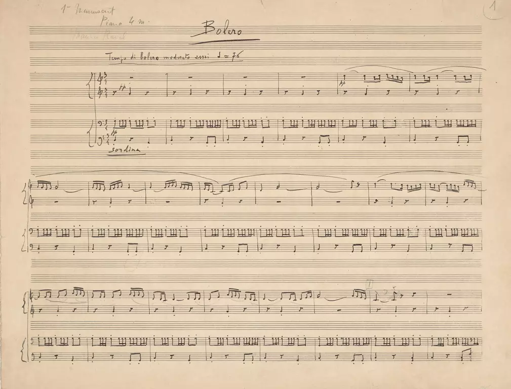 Boléro: Je, muziki maarufu wa Maurice Ravel ulitokana na ugonjwa wa ubongo? 1920_3