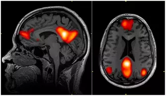 Este acto de equilibrio cerebral permite a conciencia 19770_4