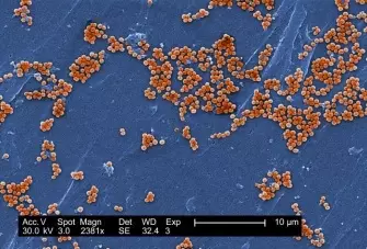 Abahanga bica superbugs hamwe na virusi 23235_2