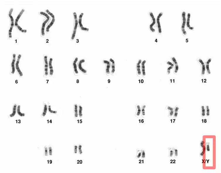 I-Y chromosome iyanyamalala - pho kuzokwenzekani emadodeni? 24489_2