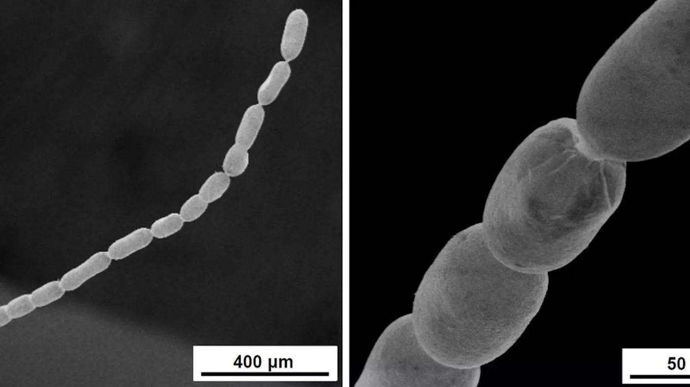 «Невероятно большие» бактерии сотрясают поле микробиологии