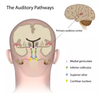 Behandlingsbar hjärninflammation kan ligga bakom tinnitus 2627_3