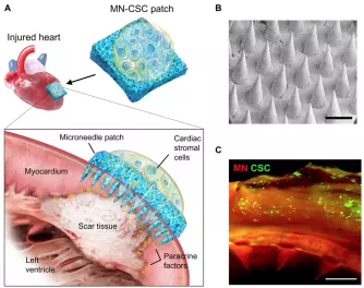 Balastarka 'microneedle' cusub ayaa ka caawin kara bukaannada wadnuhu haleelay inay dib u koraan unugyo 2672_2