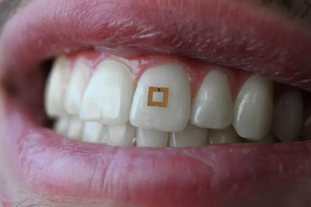 Sensor baru yang dipasang di gigi akan segera membantu Anda menurunkan berat badan 29953_0
