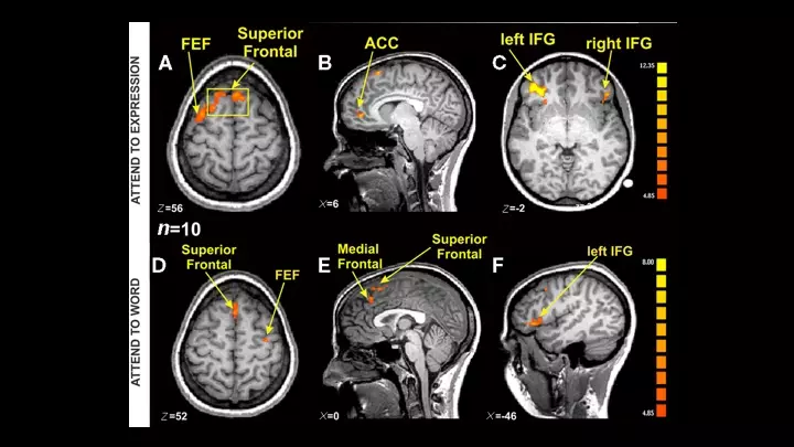 Ωχ. Είναι λάθος η πίστη μας στις μελέτες εγκεφάλου fMRI; 37489_0