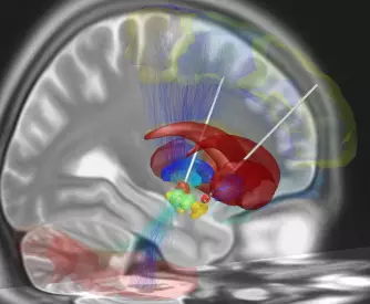 Tutkijat löytävät mielialaan liittyvät aivopiirit ja niiden hakkeroinnin 38266_5