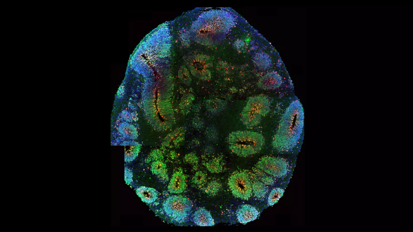 Brasilianische Wissenschaftler stellen Mini-Gehirne mit Augen her 39018_1