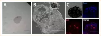 Brasilianische Wissenschaftler stellen Mini-Gehirne mit Augen her 39018_2