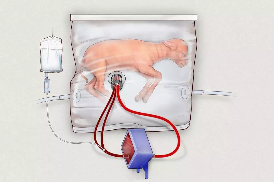 Des utérus humains artificiels se rapprochent alors que les scientifiques élèvent des agneaux dans des conditions uniques 43066_1