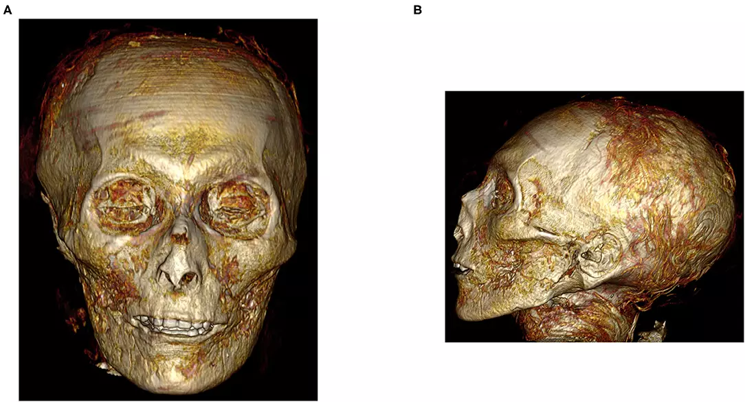 Amenhotep I: CT-Scans kréien en Abléck an der Mumie 4509_3