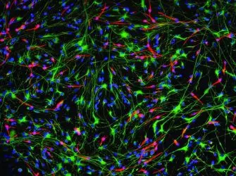 Células do cérebro humano não continuam a crescer na idade adulta, de acordo com um novo estudo 47350_4