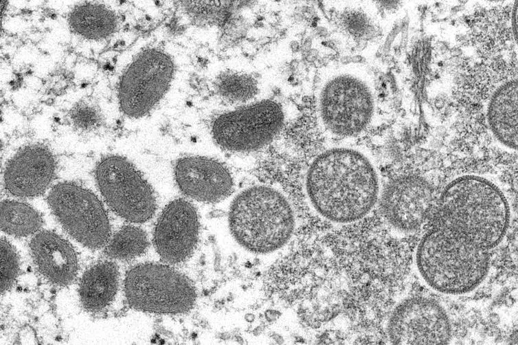 Pohled z elektronového mikroskopu na opičí neštovice, ukazující oválné, zralé virové částice a sférické, nezralé viriony