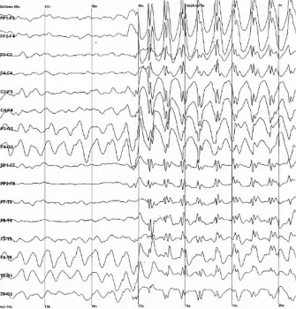 Uma Sizokhuluma Ngama-Brainwaves, Kufanele Sazi Ukuthi Ayini 49593_6