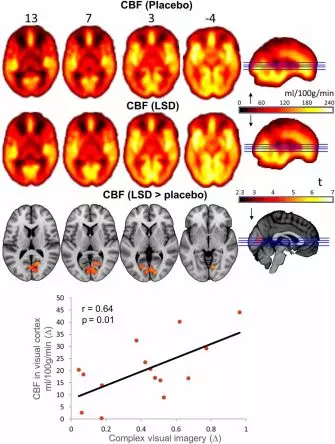 Štúdia ukazuje, ako LSD napodobňuje myseľ dieťaťa, keď sa ego rozpúšťa 51186_3