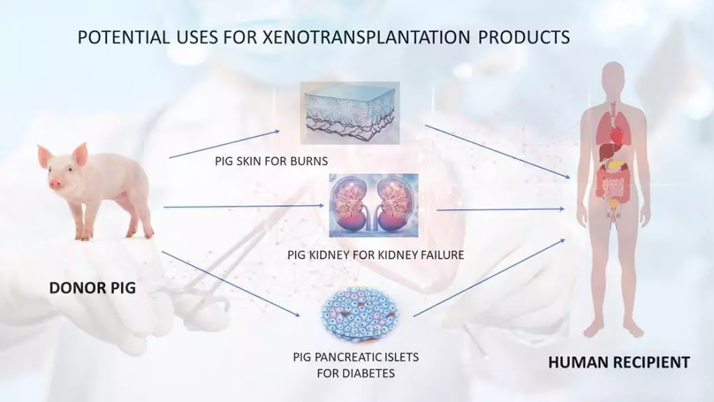 Ang high-tech nga produksyon sa mga organo para sa transplantation mao ang atong kaugmaon 5334_2