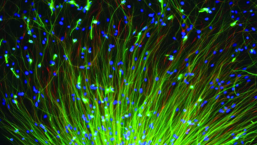 Wiring the Brain: Wéi Virussen kënne konstruéiert ginn fir Neural Verbindungen ze verfolgen 58407_0