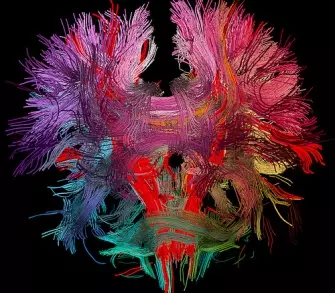 חיווט המוח: כיצד ניתן לעצב וירוסים כדי להתחקות אחר חיבורים עצביים 58407_3