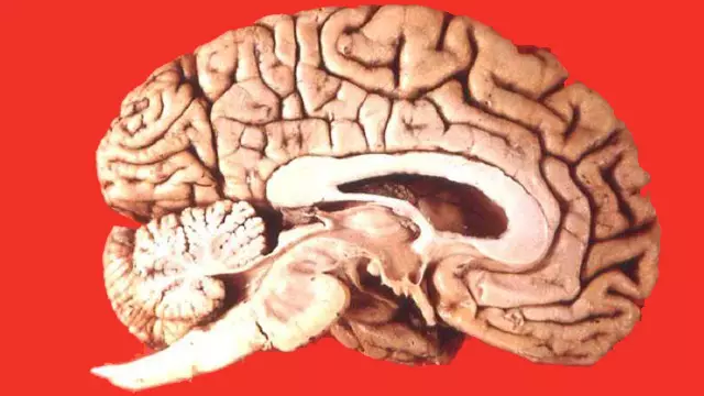 Neuralne vježbe potiču starenje mozga 59747_0