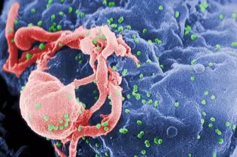 Zdá se, že pacient s HIV je vyléčen – první, říkají vědci 60412_4
