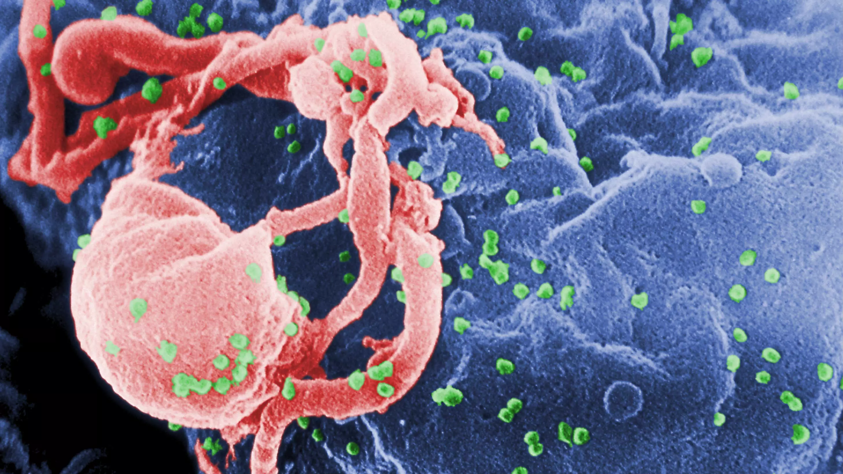 سه راه امیدوار کننده ترین تحقیقات ایدز 76323_0