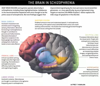 Шизофрения, вероятно, является побочным эффектом сложной эволюции нашего мозга. 7693_4