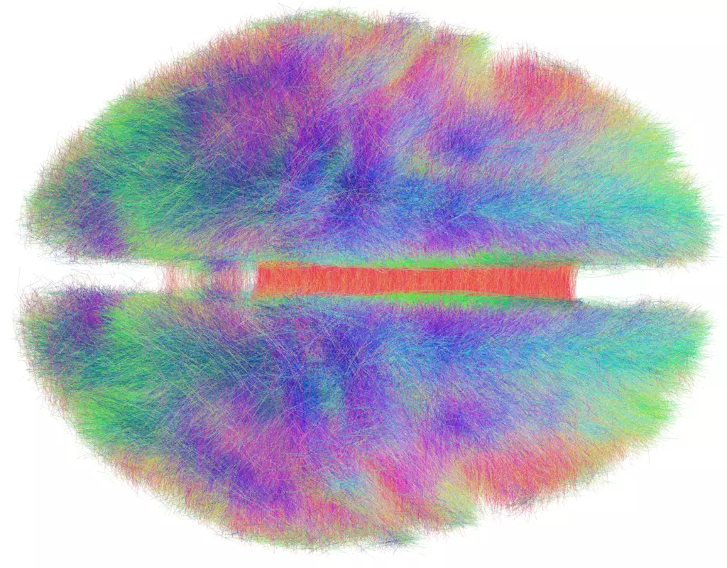 Superdatorn Aurora 21 kommer att kartlägga den mänskliga hjärnan, med start 2021 9538_0